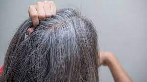 Hair Disease - Dr. Swapnil Deshmukh - Hair and Skin Specialist in warje ...